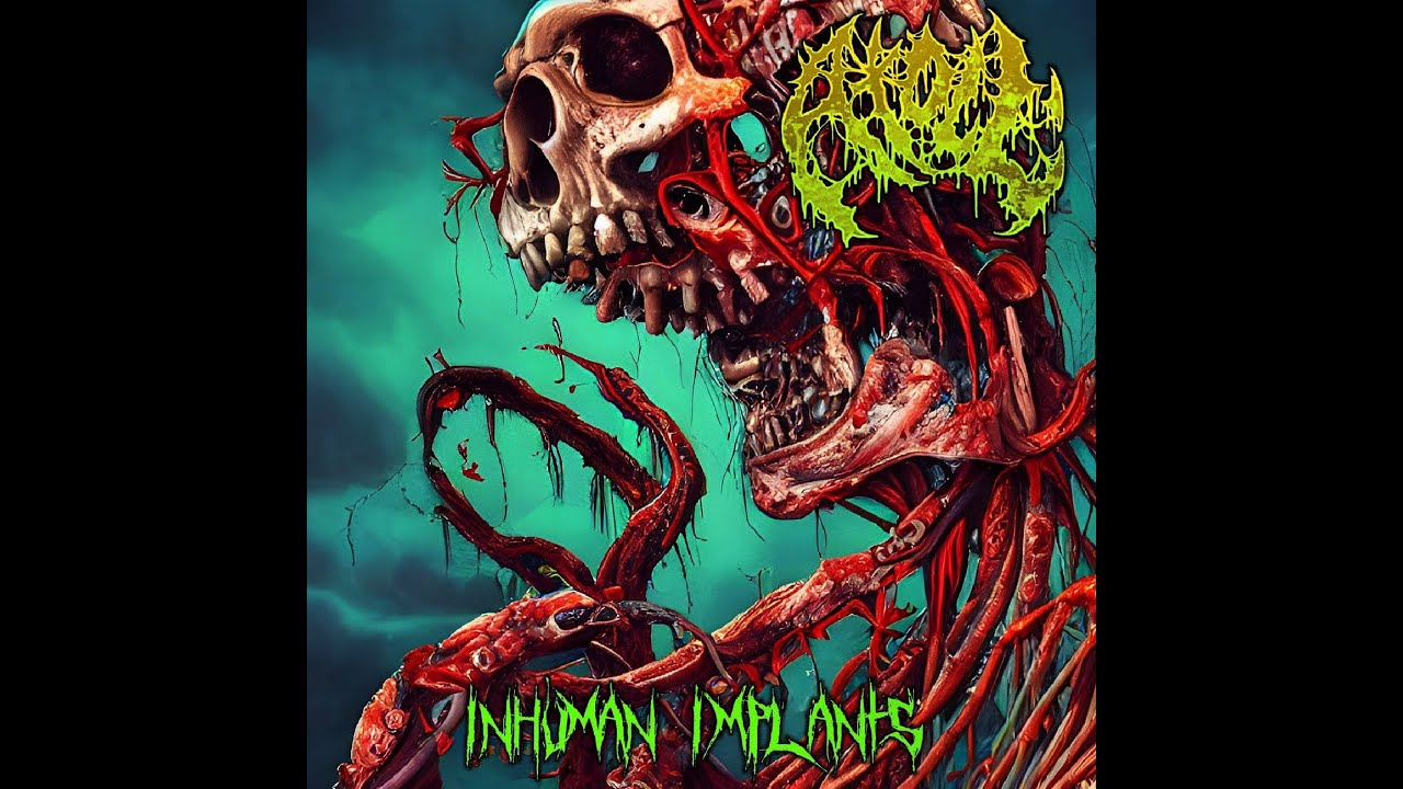 Atoll - 2024 - Inhuman Implants (Brutal Death, DR10) - YouTube