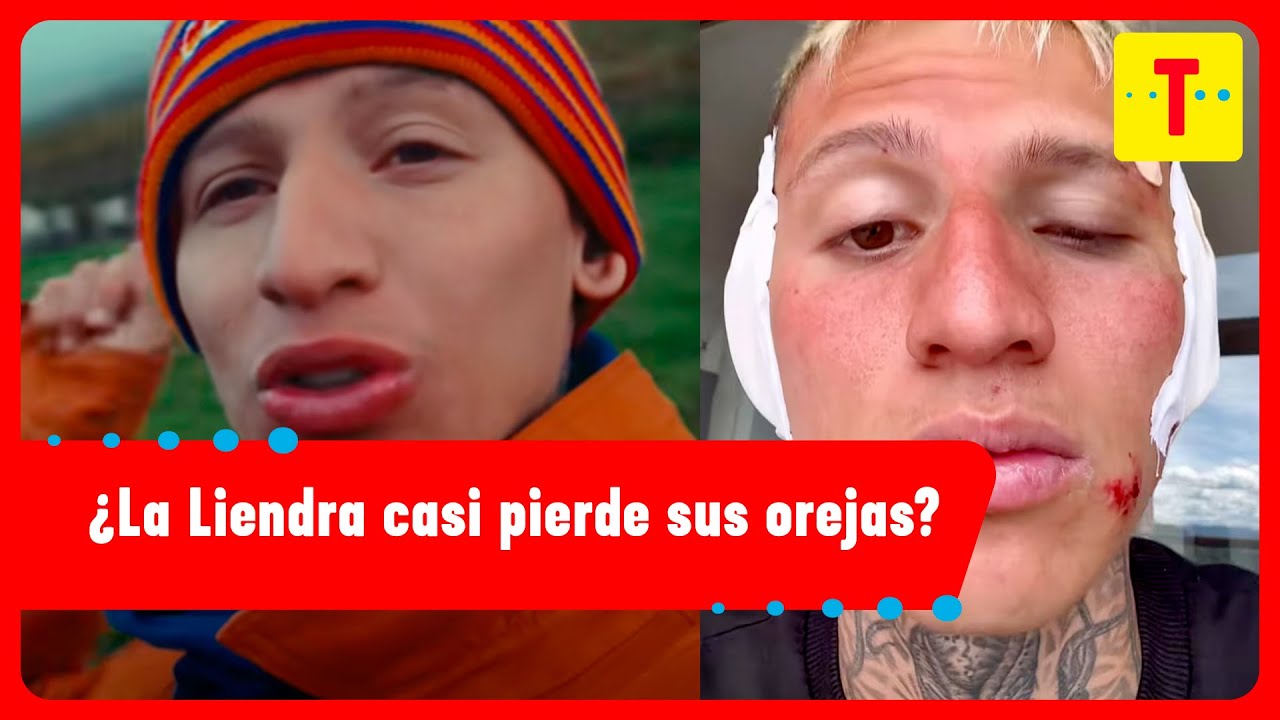 La Liendra reaparece en redes y sorprende con su aspecto | ¿Cómo ...