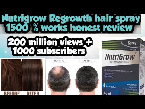 ||Nutrigrow hair regrowth treatment spray grows hair in one week ...