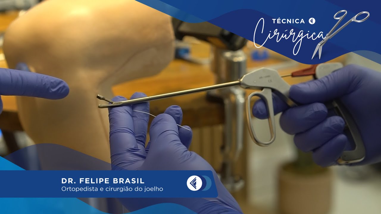 Sutura do Menisco ALL INSIDE - YouTube