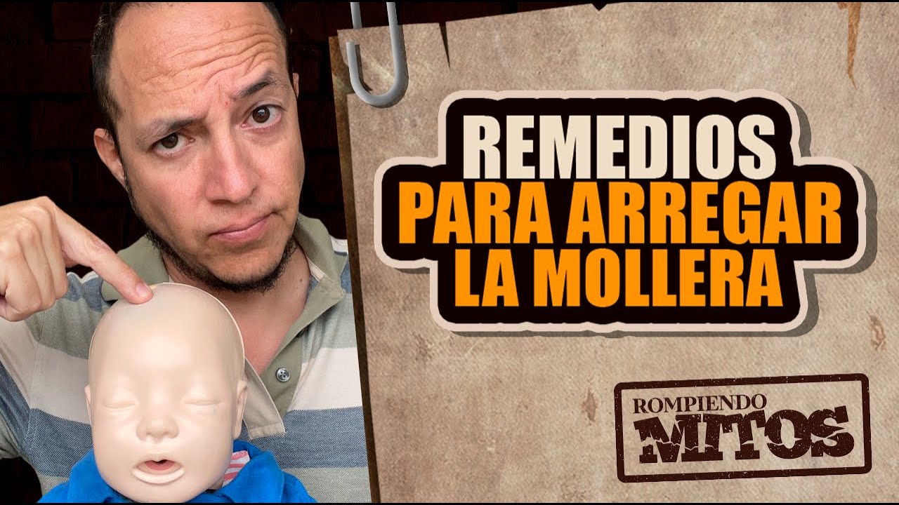 ¡Que no se le caiga la mollera a tu bebé! (Y si ya le pasó, soluciónalo ...