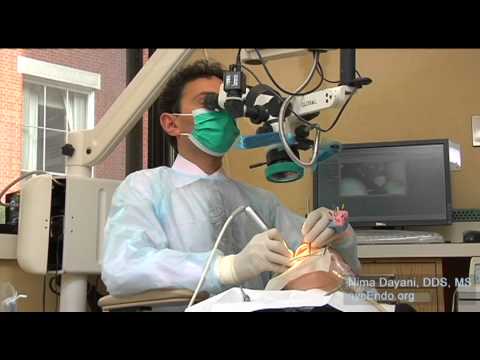 Dr. Nima Dayani DDS, MS, a NYC endodontist, performs root canal ...
