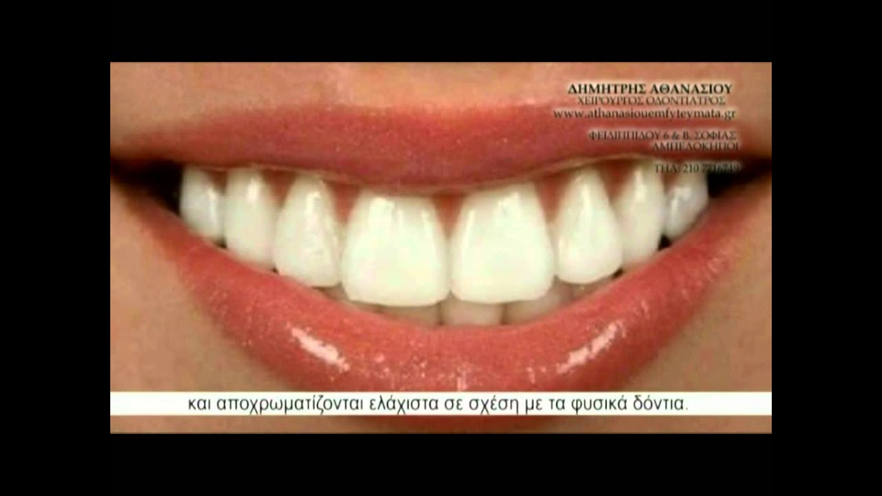 Αισθητική Οδοντιατρικη στην Αθήνα | implantsforall.gr - YouTube