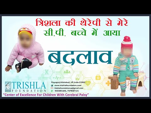 CP Success Stories: A Cerebral Palsy Affected Child can Walk with Proper Cerebral Palsy Therapy