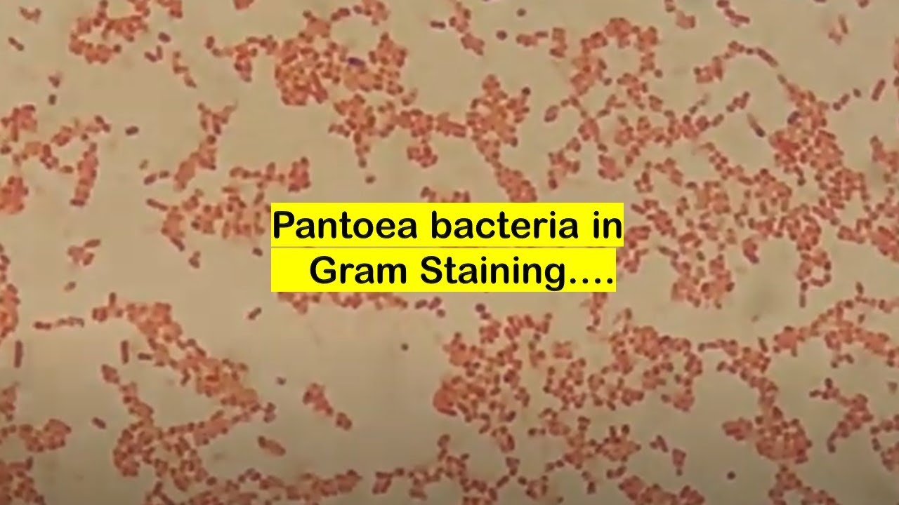Pantoea in Gram Staining - YouTube