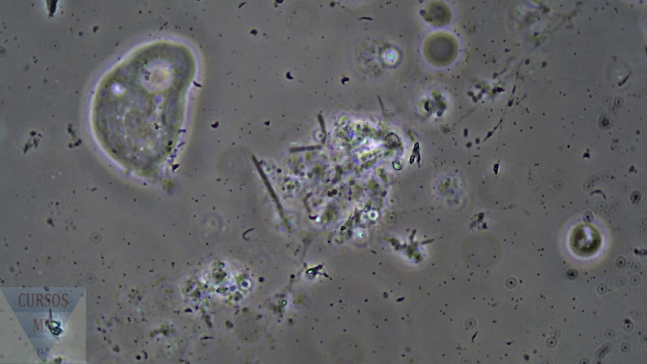 Macrófago en microscopio de contraste de fases - YouTube