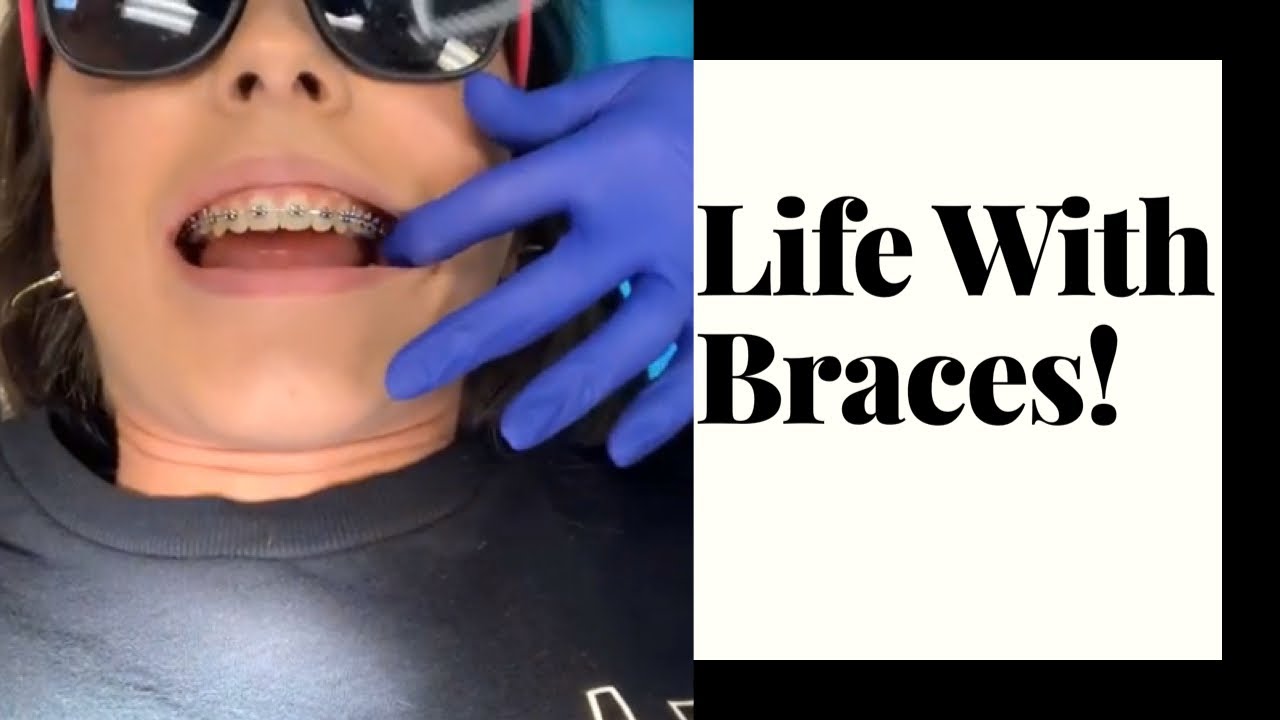 Life With Braces!! 😁 - YouTube