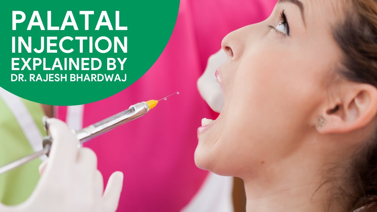 Palatal Injection for Snoring | खर्राटों के लिए पैलेटल इंजेक्शन | Dr ...