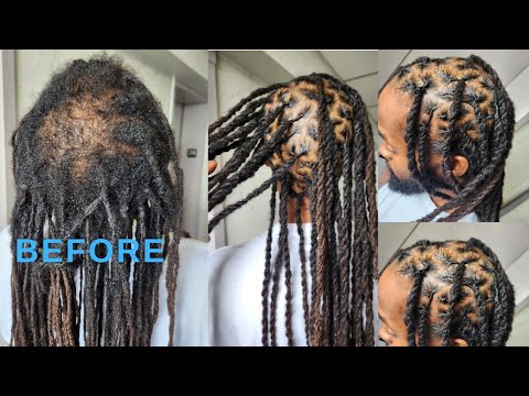 HOW TO: COOLEST LOC TRANSFORMATION //REPLACING BALD SPOTS WITH NATURAL ...
