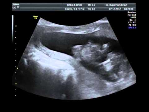 Ultralyd video 12+2 1 av 5 - YouTube