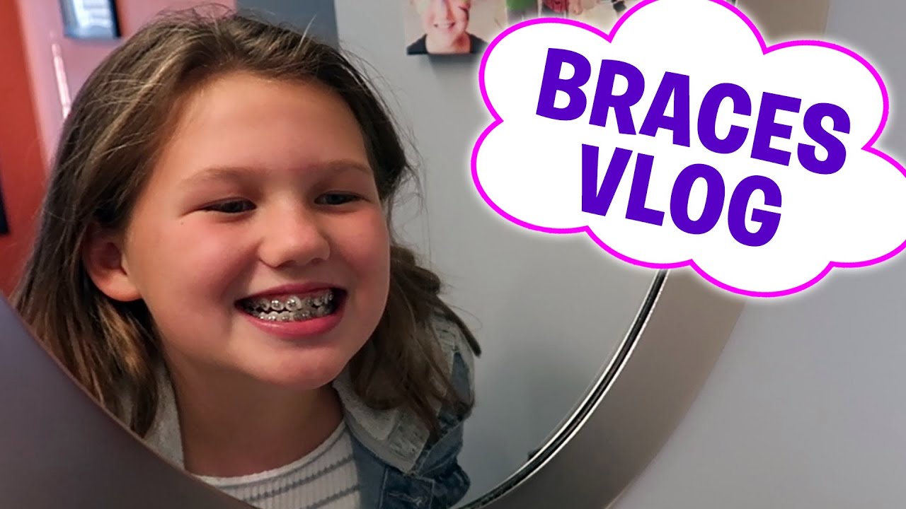 I GOT BRACES and it was SUPER EASY! | MY BRACES VLOG - YouTube