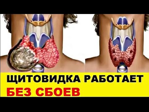 Щитовидка ГОЛОДАЕТ БЕЗ ЭТОГО ! Продукт, который сделают щитовидную ...