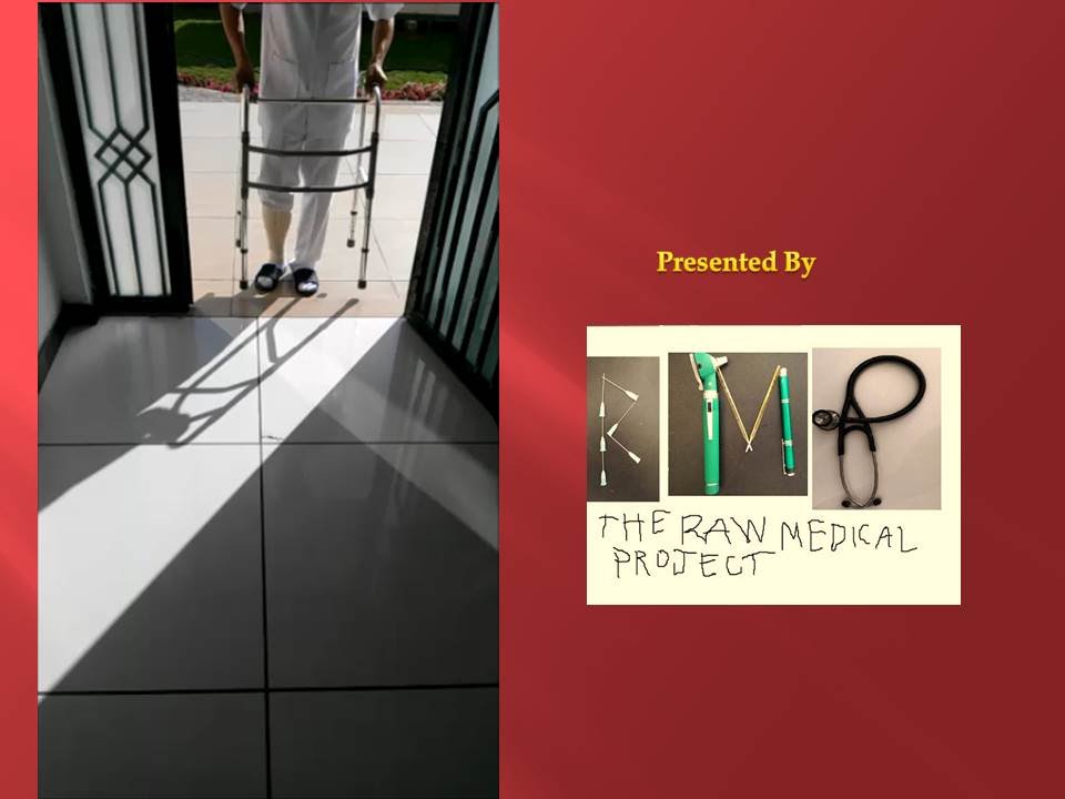 How to use walker safely while going up and down a step or elevated are ...