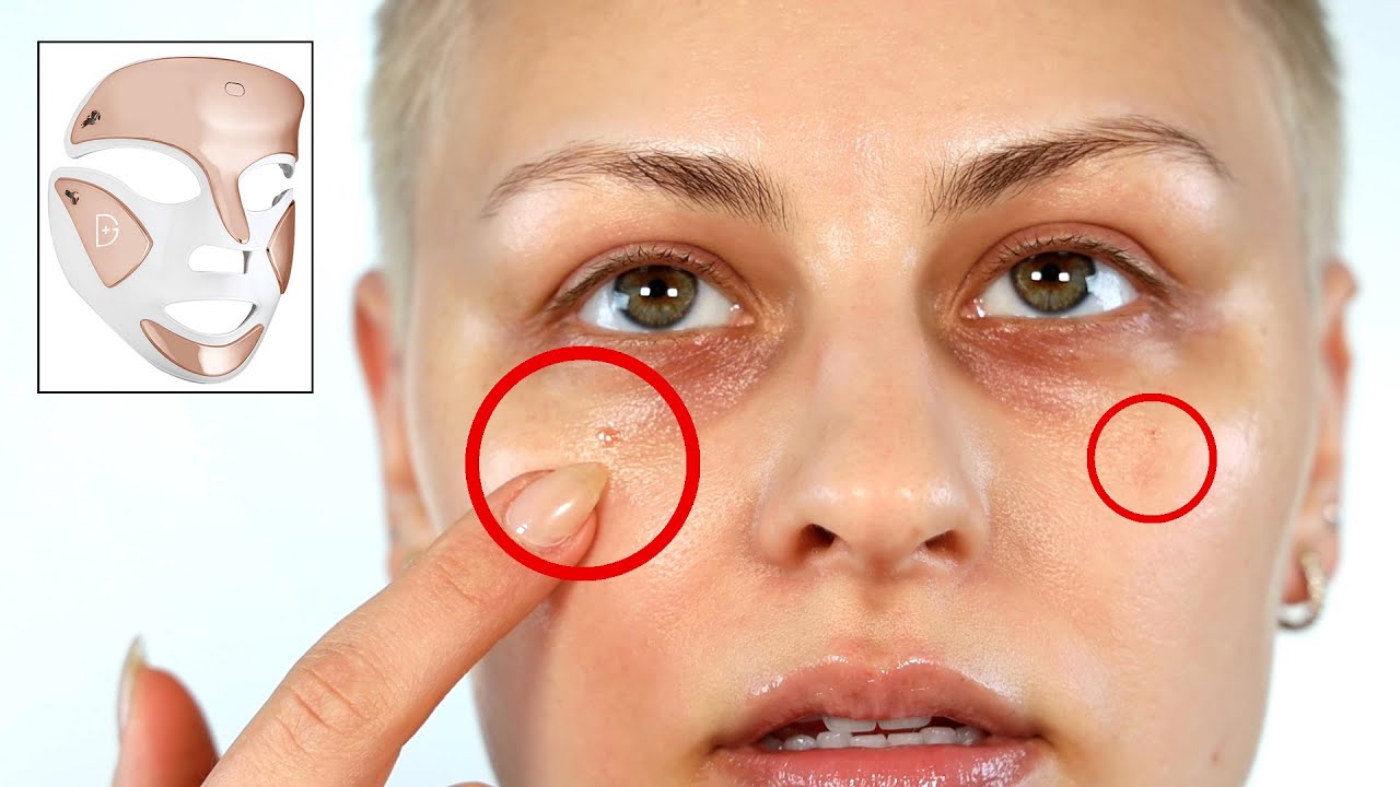 Before you buy an LED light mask... - YouTube