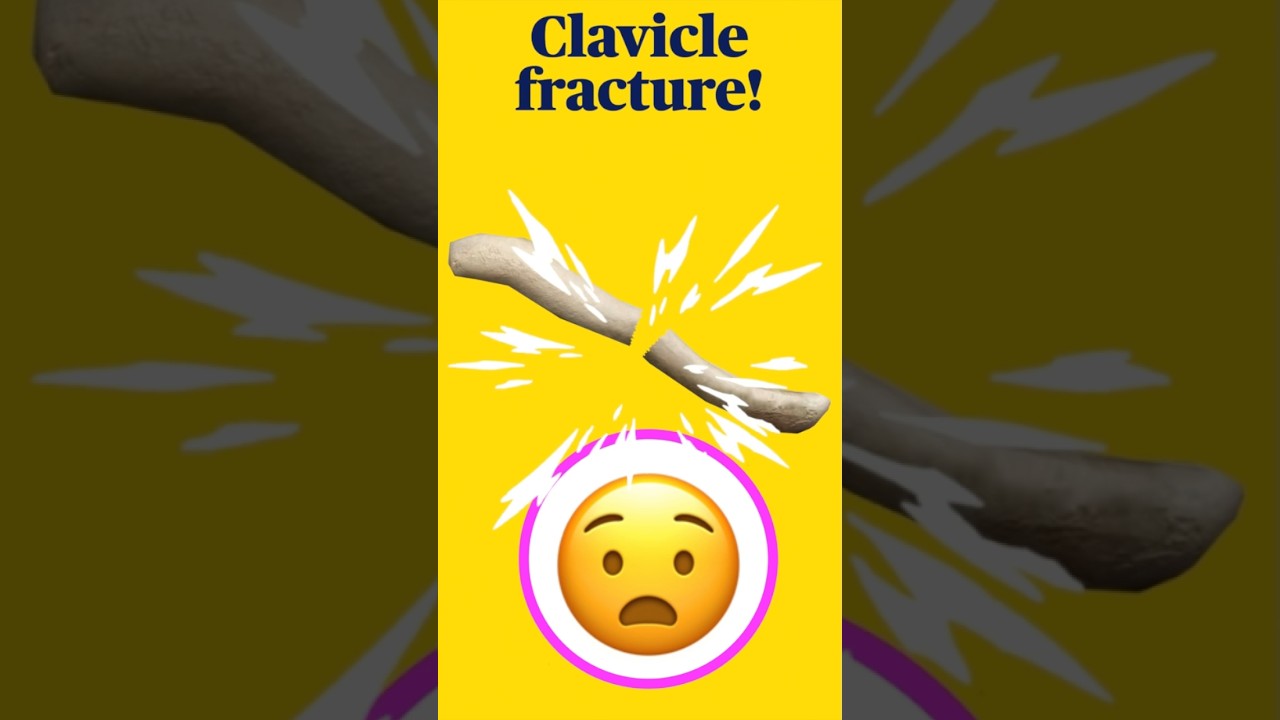 Clavicle analgesia without complications? Try the clavipectoral block ...