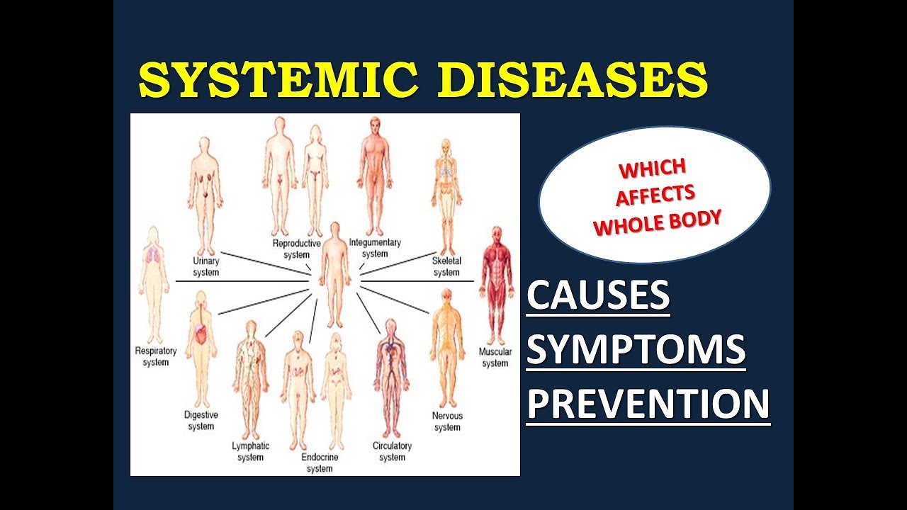Systemic Diseases Causes Symptoms Prevention - YouTube