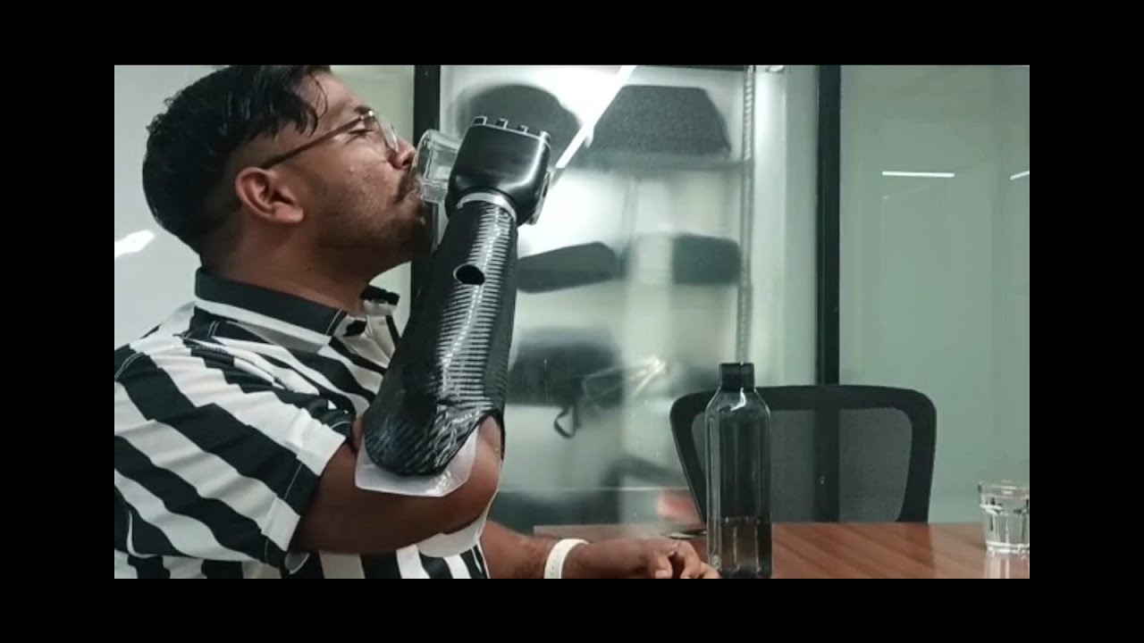 KalArm® Bionic Hand in Action - YouTube