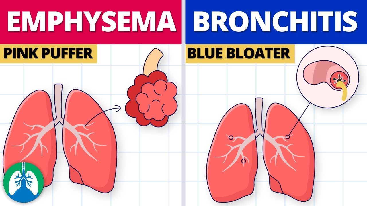 Emphysema Pathophysiology Simple