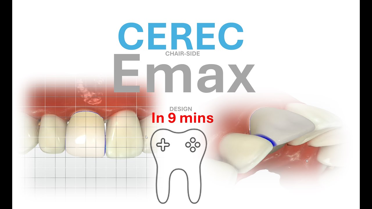 CEREC chairside Emax design Tutorial in 10mins- Grid mode- Copy ...