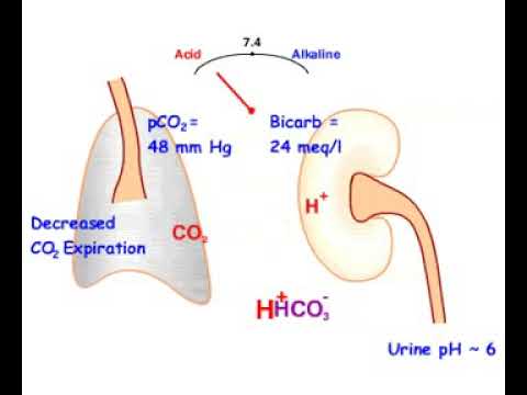 Respiratory Acidosis - YouTube