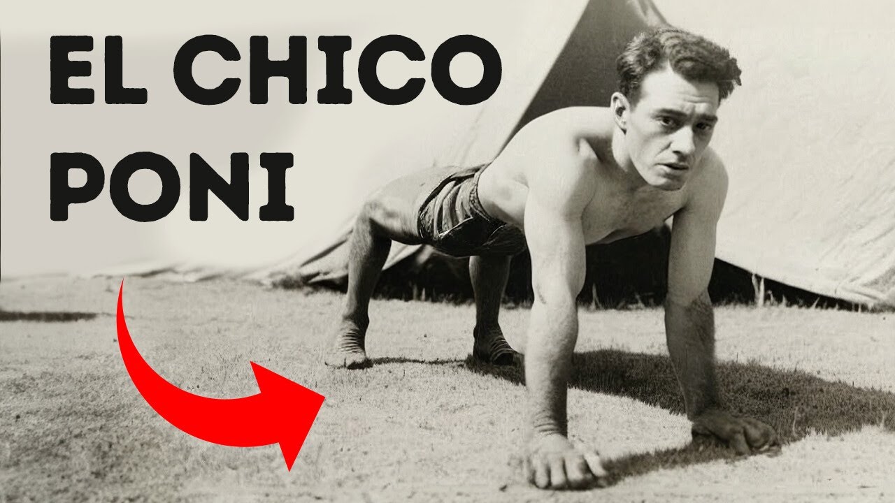 La asombrosa historia de “El chico poni” - YouTube