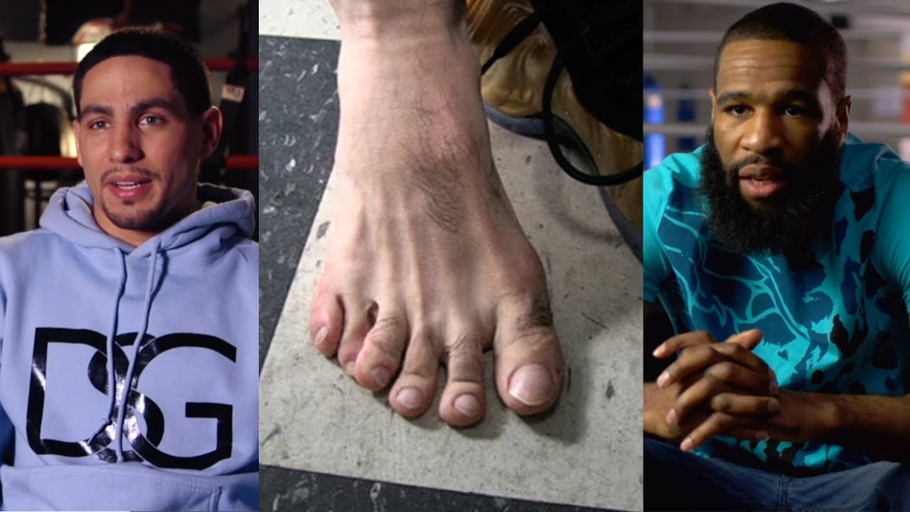 DANNY GARCIA HAS 6 TOES + DANNY GARCIA VS LAMONT PETERSON OFFICIAL ...