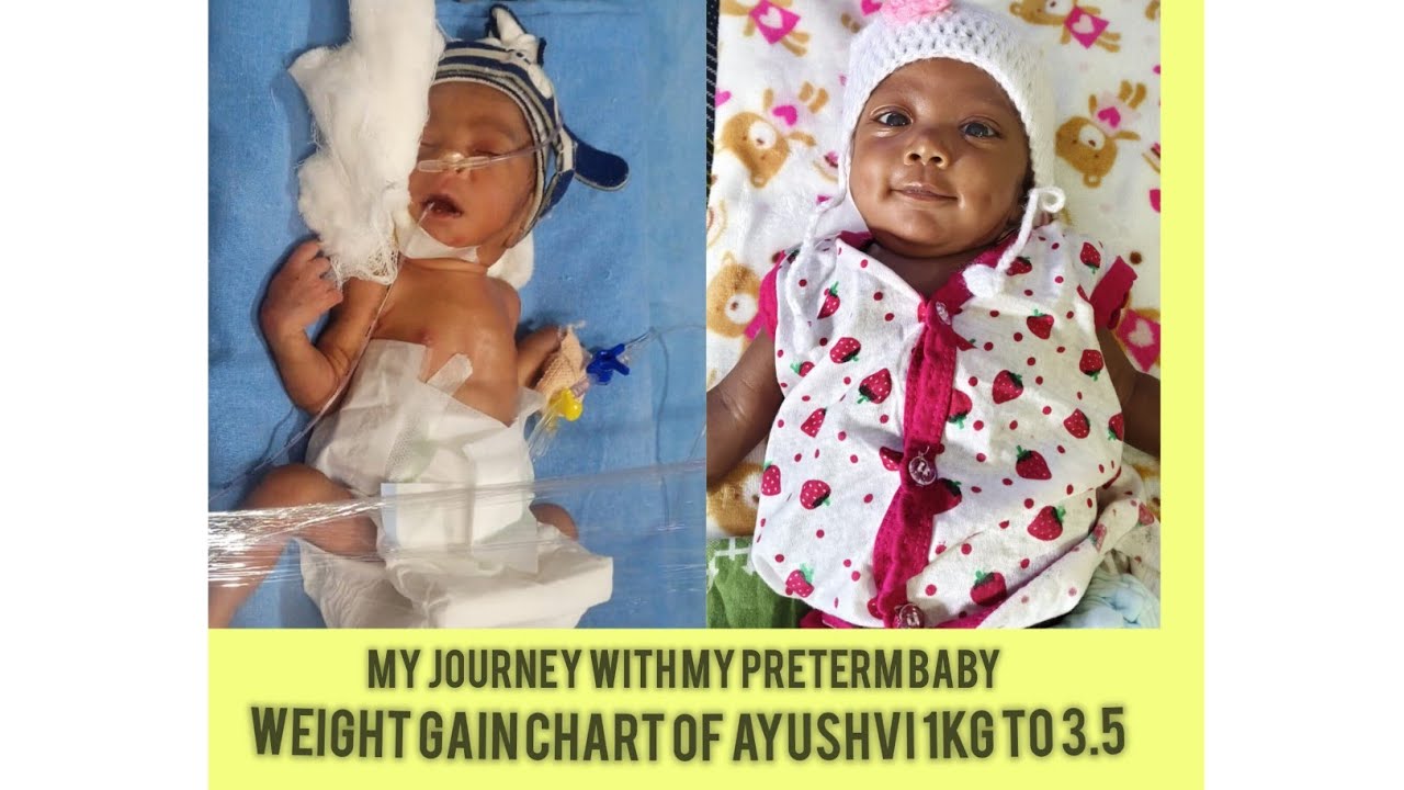 My Preterm baby journey 1kg to 3.5kg - YouTube