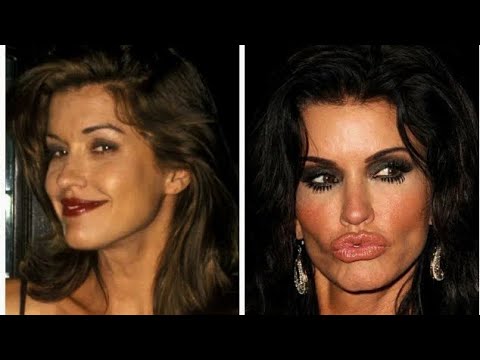 Plastic Surgery Gone Wrong: Celebs Who Regret Going Under the Knife and ...