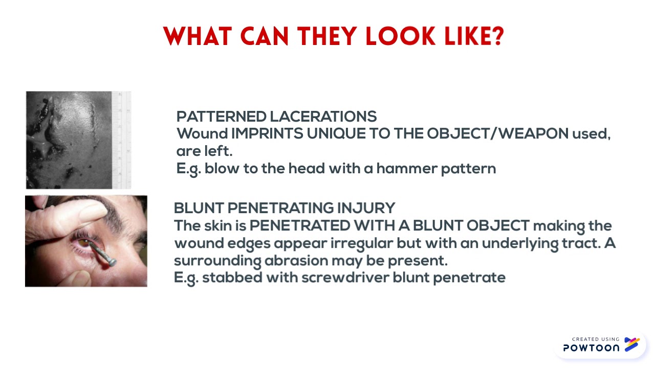 Forensics Lacerations Video - YouTube