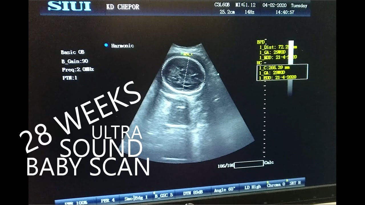 28 WEEKS BABY ULTRASOUND SCAN - YouTube