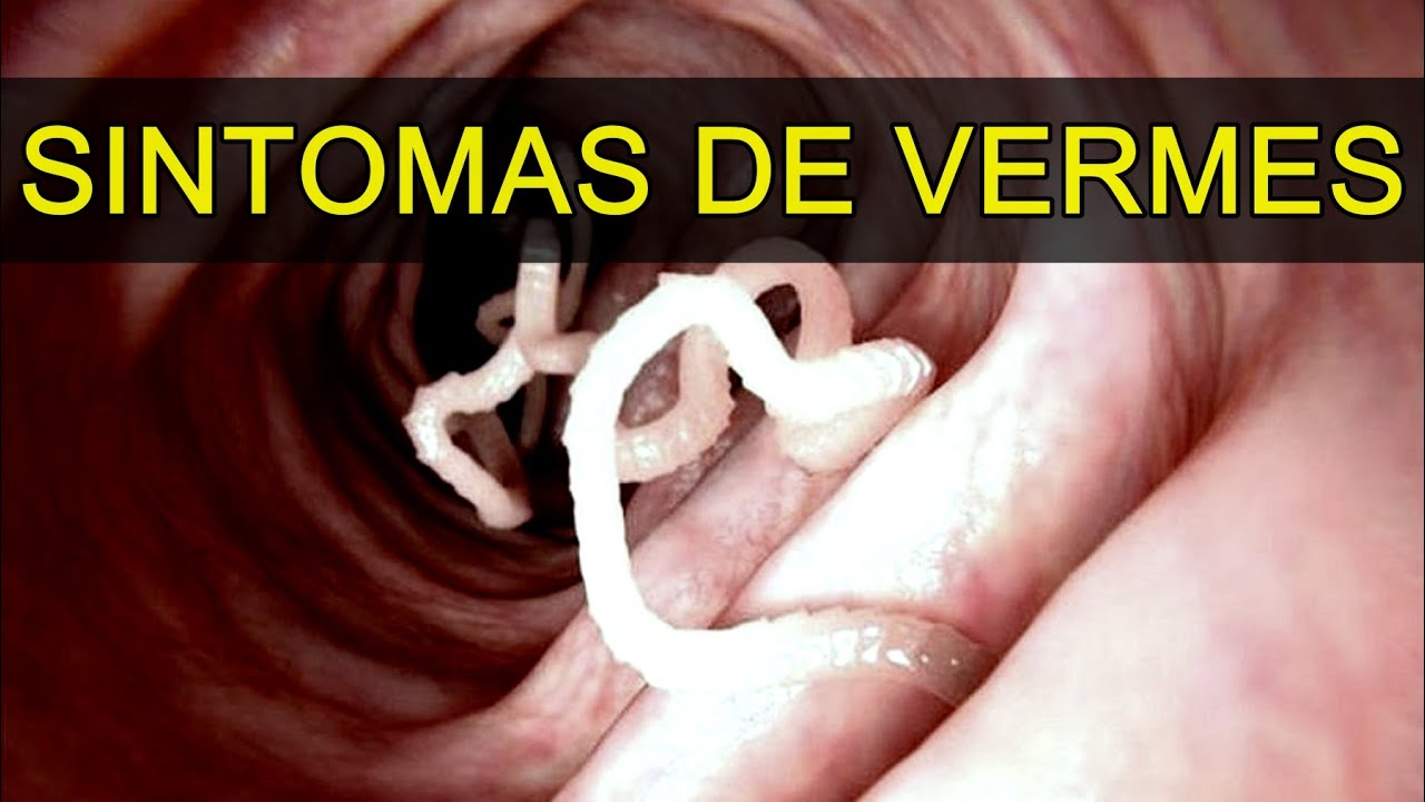 VERMES - SINTOMAS E REMÉDIOS NATURAIS - YouTube