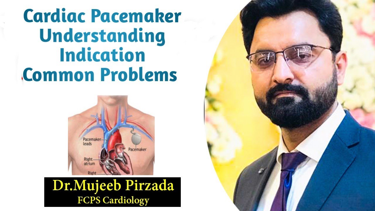 What Is Heart Pacemaker | Pacemaker Understanding | Pacemaker Common ...