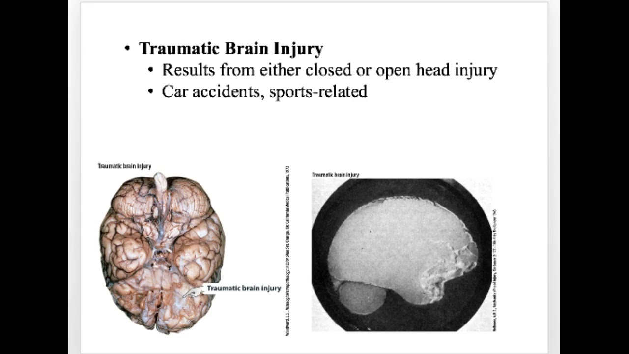 Chapter 3 Methods of Cognitive Neuroscience - YouTube