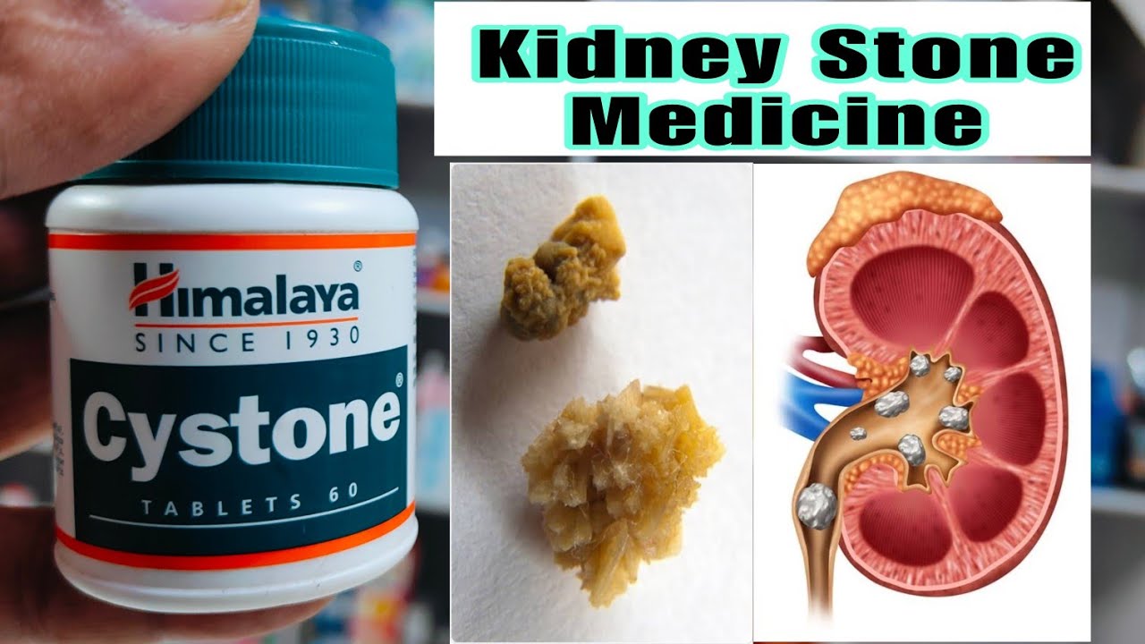 Best ayurvedic medicine for kidney stone | Cystone tablet | Himalaya ...