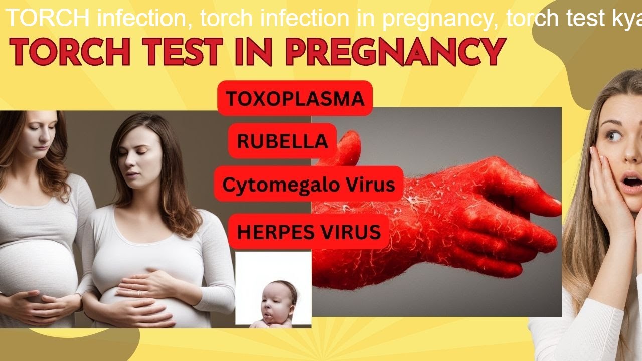 TORCH Infection: Are You at Risk? Find Out Now #torchinfection #rubella ...