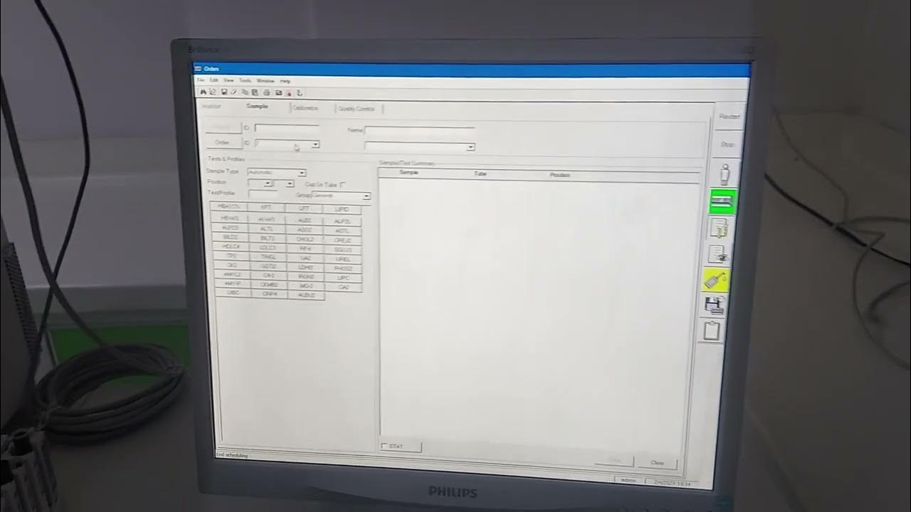 طريقة عمل فحص على جهاز cobas integra 400 plus - YouTube