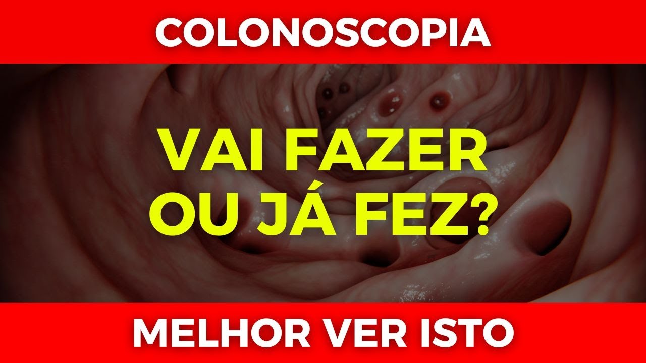 COLONOSCOPIA: o que acontece durante e após? [PASSO A PASSO] - YouTube