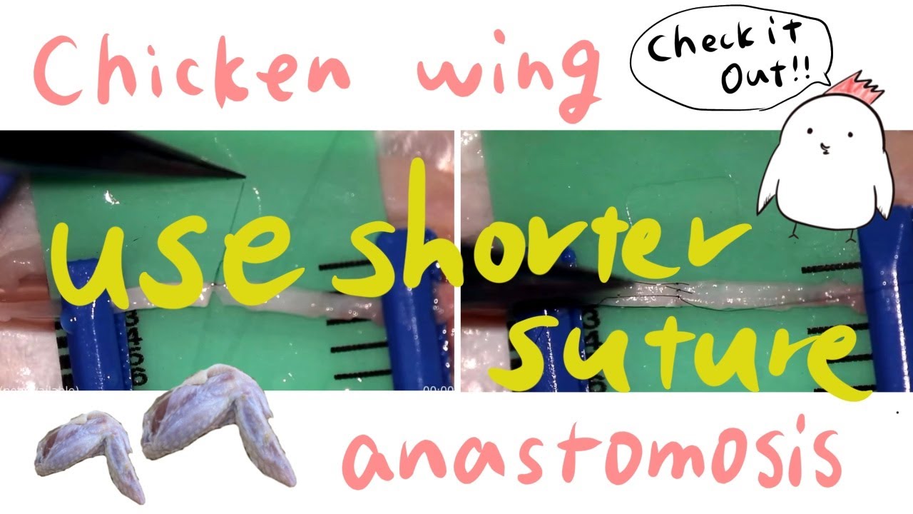 【microsurgery 7】Use shorter suture chicken wing anastomosis.いつもより短い糸を使っ ...
