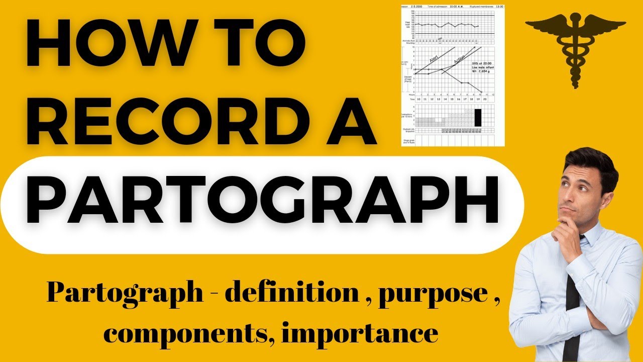 " Partograph " in labour | Partograph plotting | Partograph kaise bhare ...