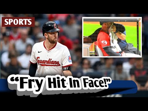 Guardians’ David Fry Hit In Face By Fastball, Exits Game vs Tigers ...