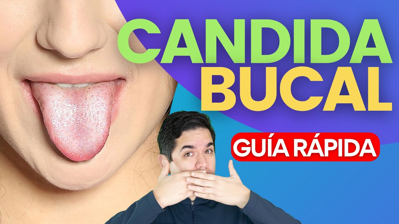 Combate La CANDIDIASIS BUCAL 🦷👀👅 - YouTube