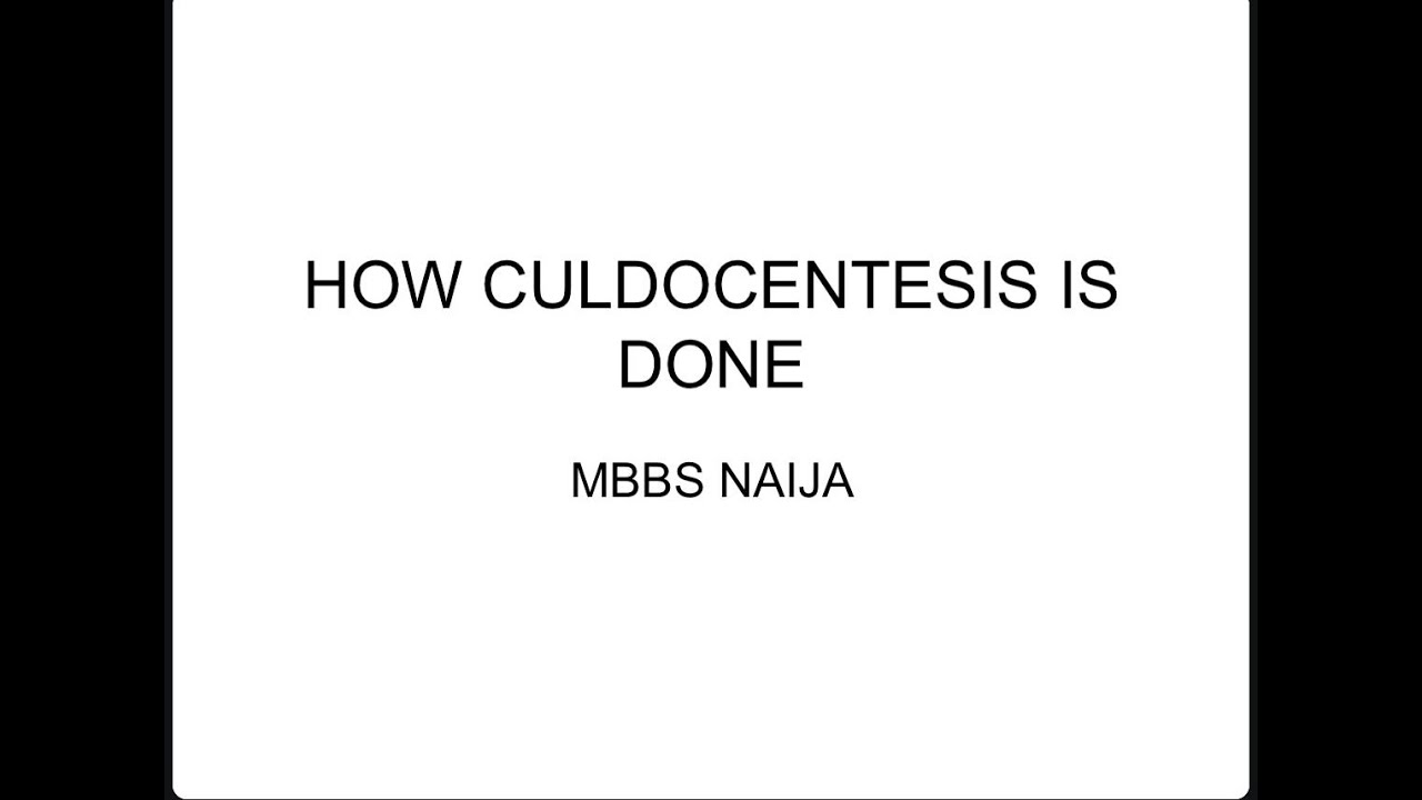 How is Culdocentesis Done / Step by step how Culdocentesis procedure is ...