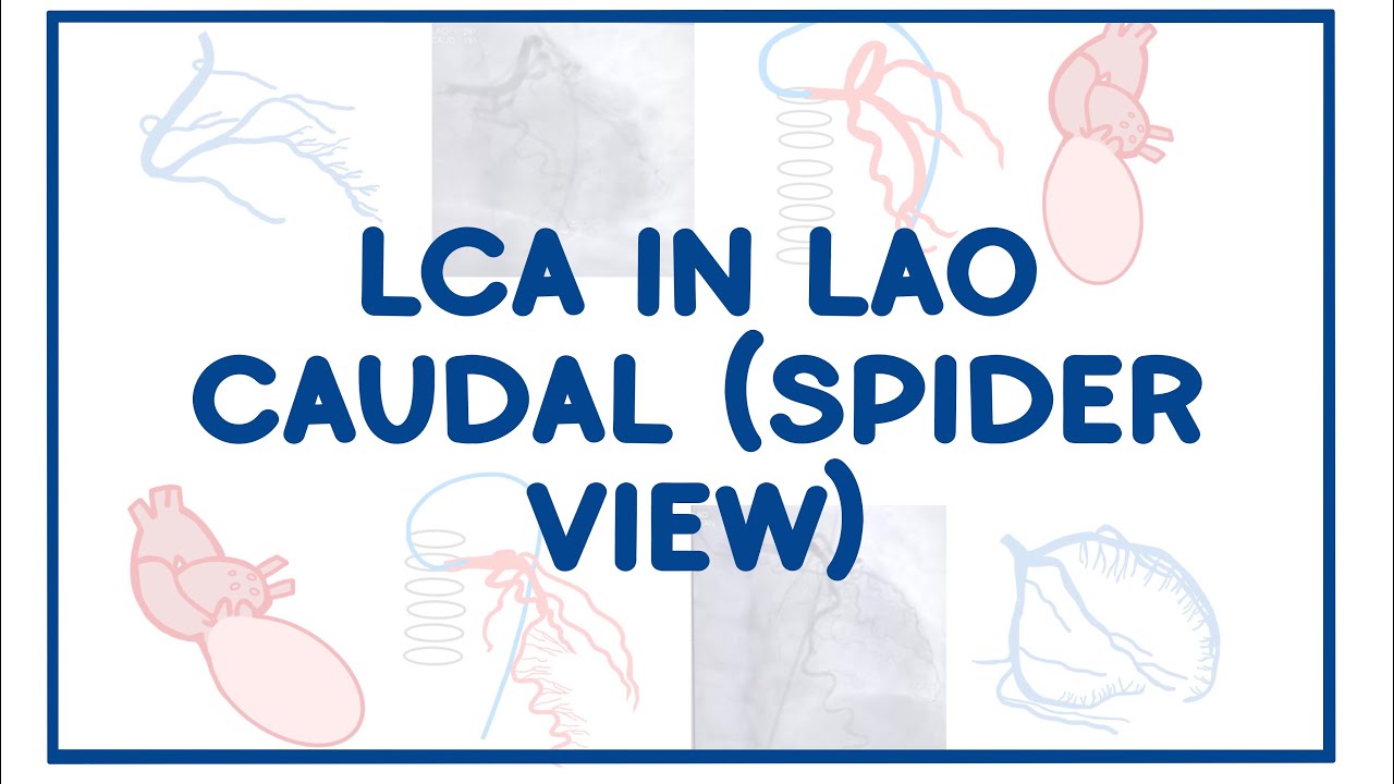 LAO CAUDAL - Spider View - YouTube