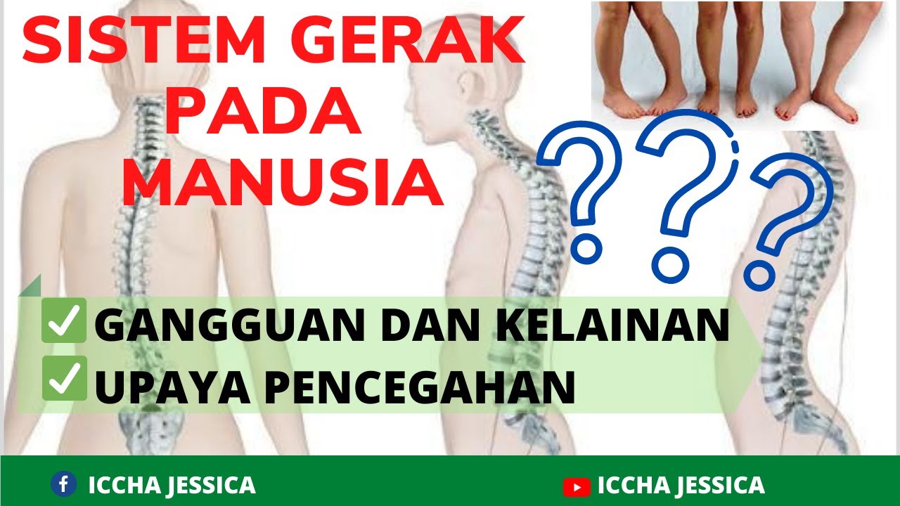 Gangguan dan Kelainan pada Sistem Gerak Manusia - YouTube