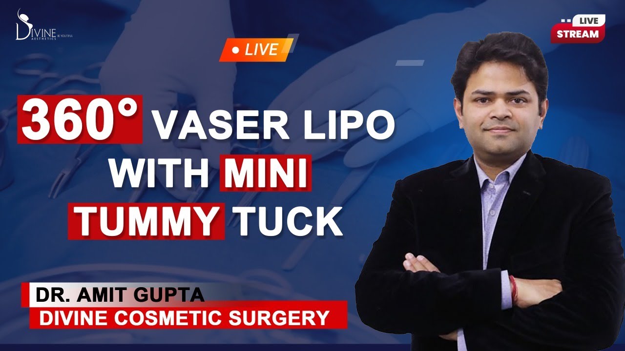 360 Vaser Lipo With Mini Tummy Tuck, 1st Step - Back Lipo - YouTube
