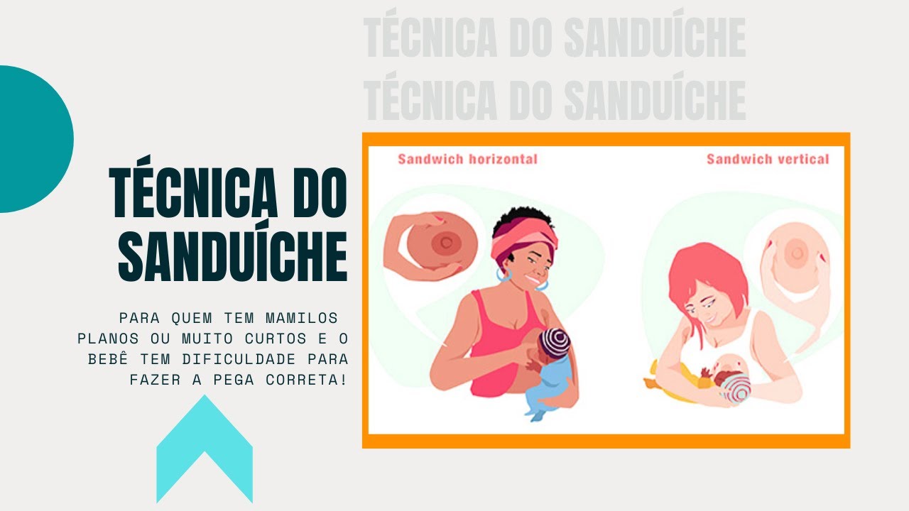 COMO AMAMENTAR COM MAMILOS PLANOS OU INVERTIDOS • TÉCNICA DO SANDUÍCHE ...