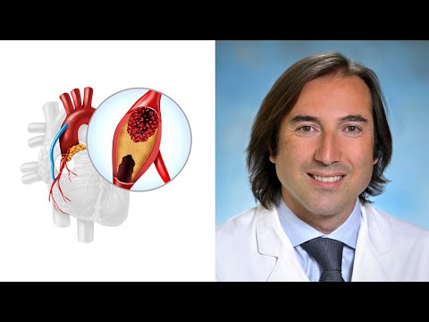 Surgeon Q&A: Coronary Artery Bypass Grafting and Heart Valve Surgery ...
