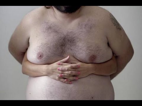 Mom Says Man's \