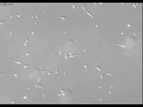 Formation of myofibres by muscle stem cells - YouTube