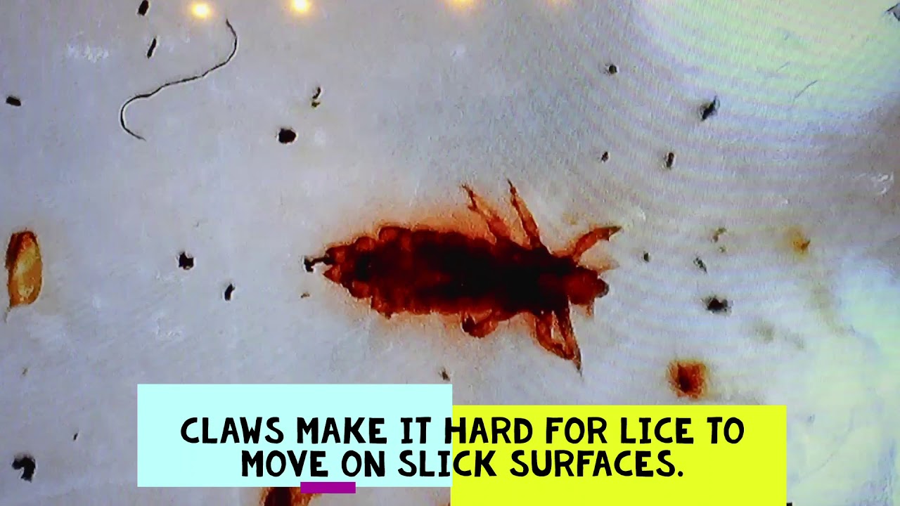 Lice Spies Female Louse - YouTube